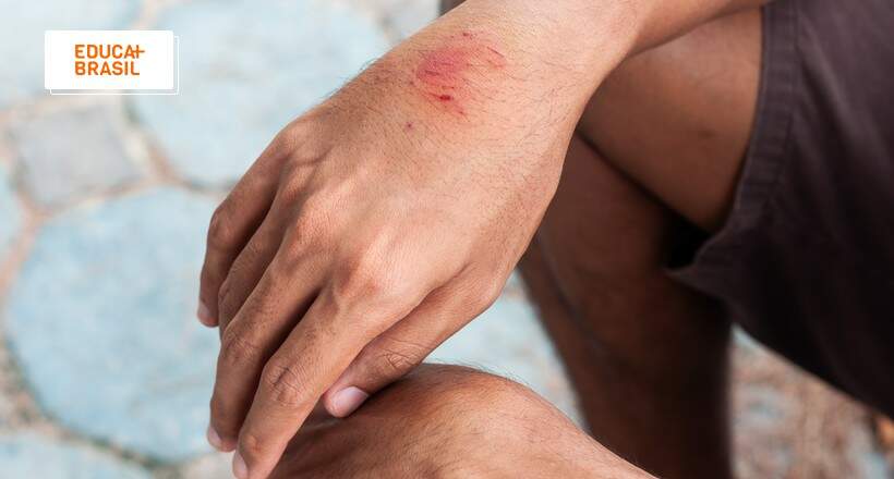 Raiva Em Humanos Raiva Humana Preocupa E, Em Dois Anos, São Sete